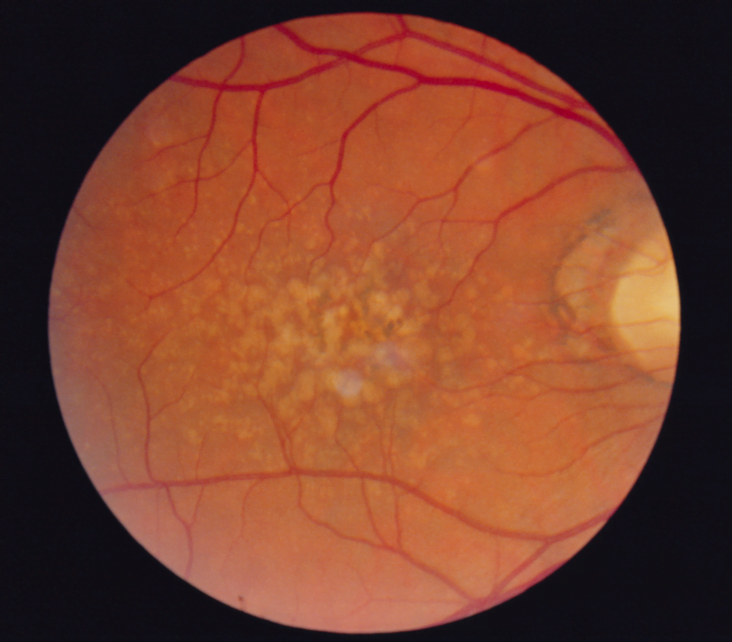 OKOLUX Centrum Okulistyki Klinicznej | Okulista I Zaćma I Laserowa ...